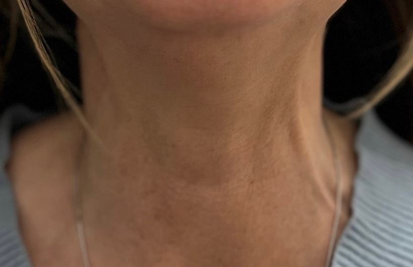 Arlington Medical Spa | Glo & Glam