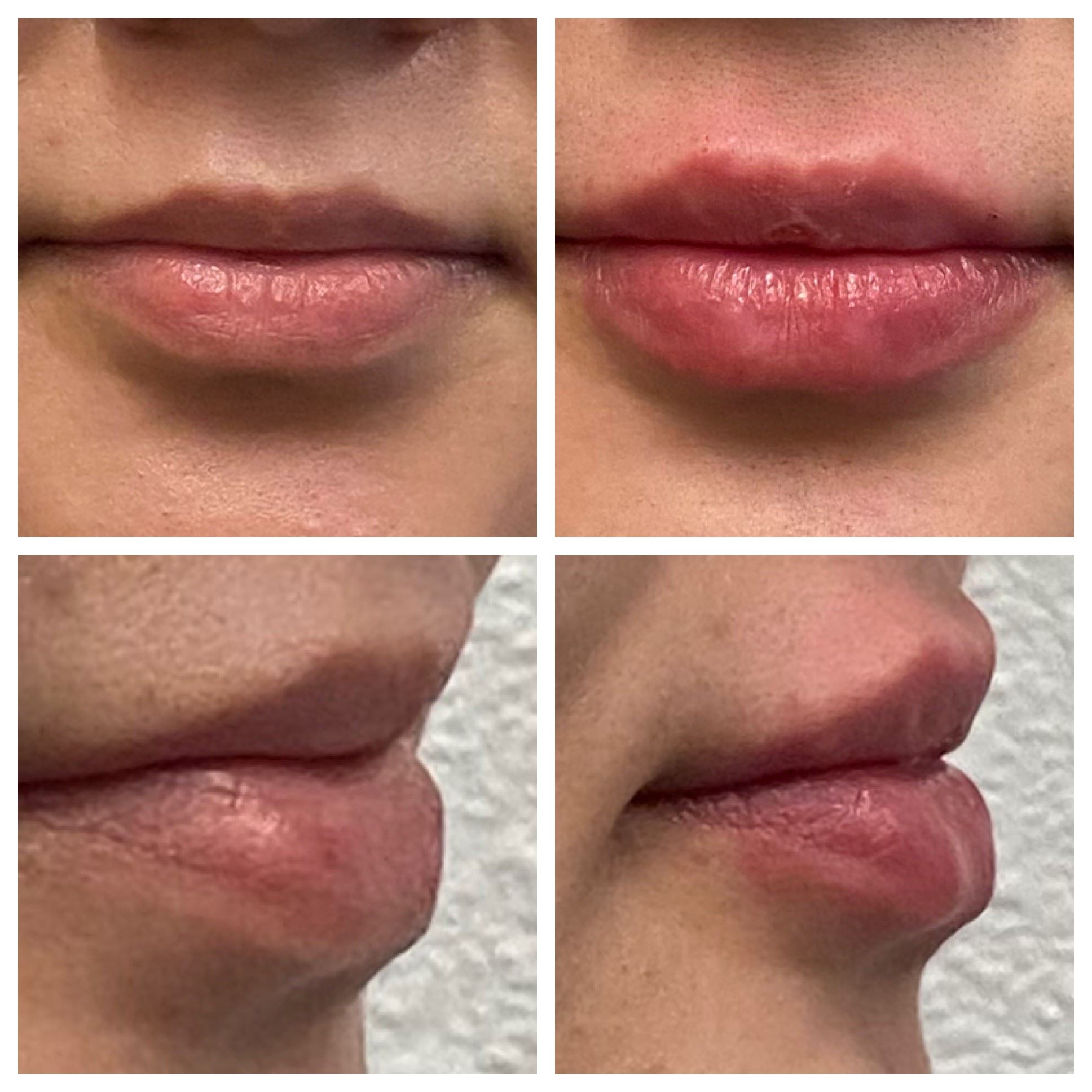 MedSpa Services | Glo & Glam